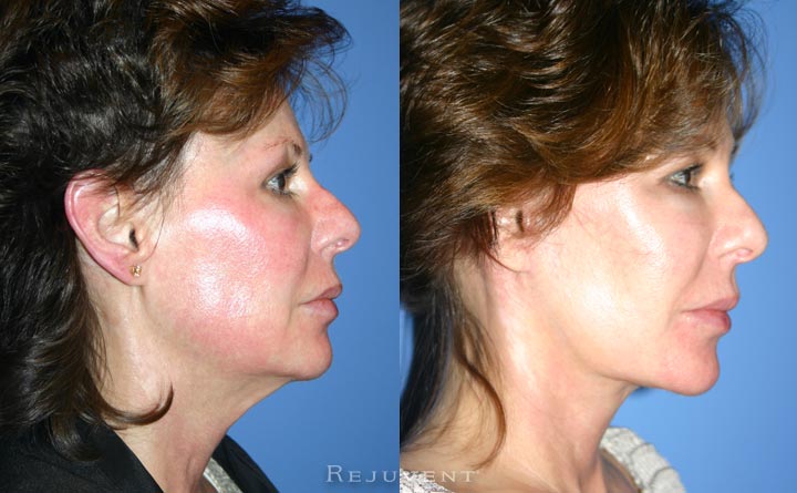 Looking Your Best in your 50s • Rejuvent Medical Spa Scottsdale