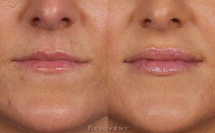 Looking Your Best in Your 30s • Rejuvent Medical Spa Scottsdale