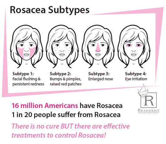 What to do for Rosacea? • Rejuvent Medical Spa Scottsdale