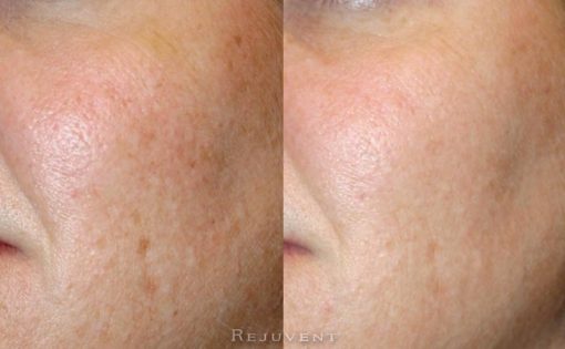 What is Your Skin Concern? • Rejuvent Medical Spa Scottsdale